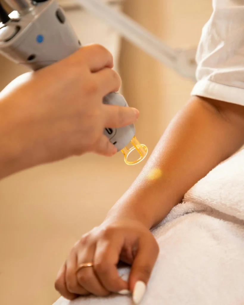 Laser Hair Removal: The Ultimate Guide to Silky-Smooth Skin (No More ...